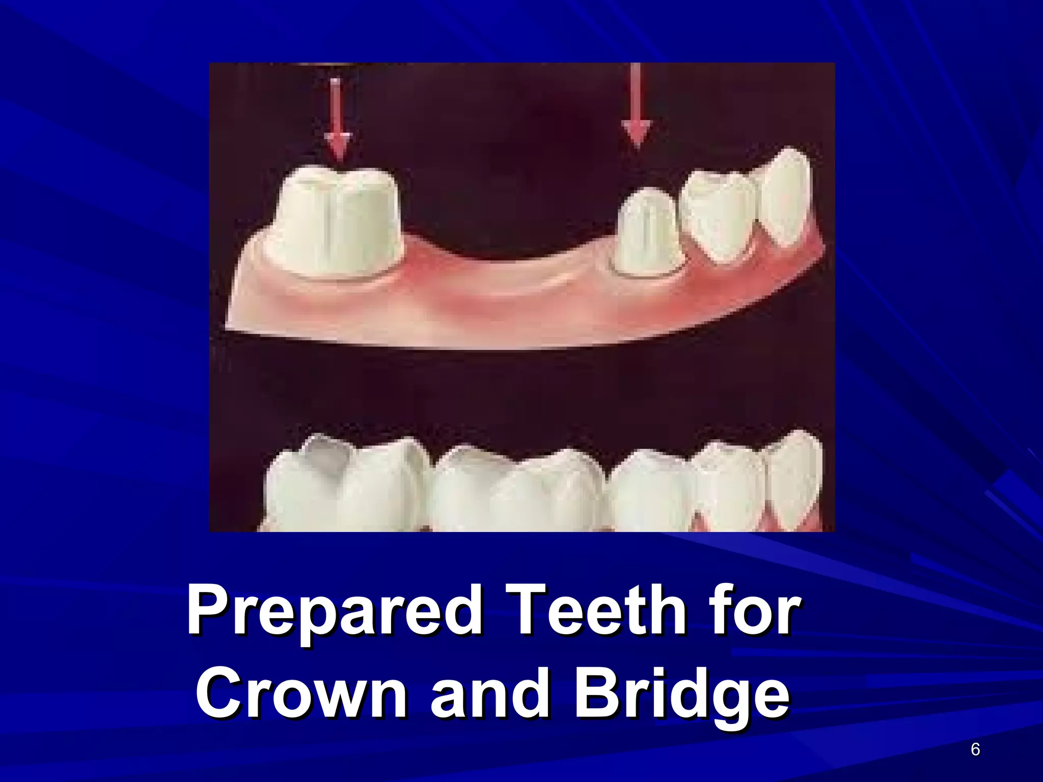 Teeth are forever oral health and the older adult | PPT