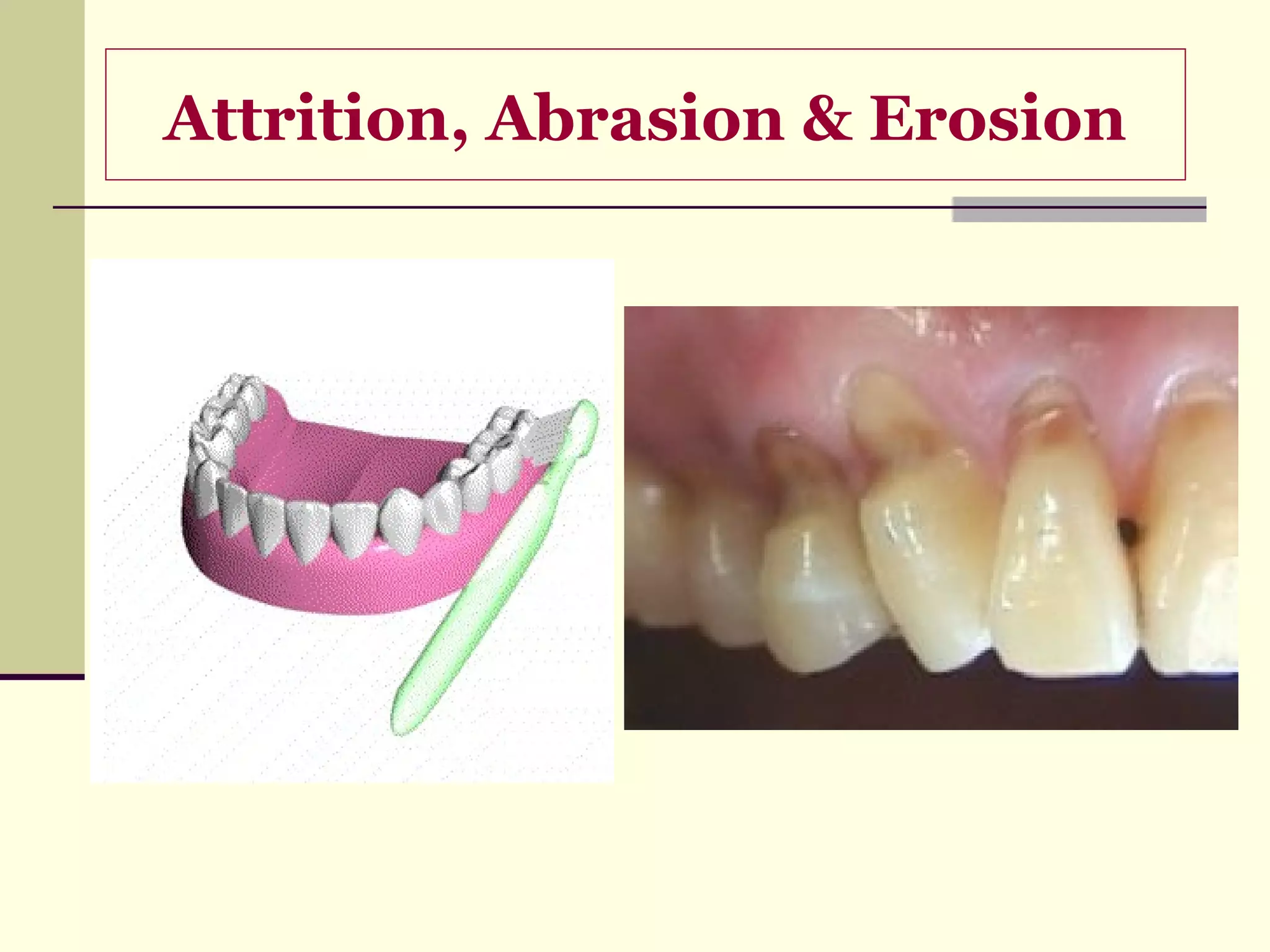 Teeth abnormalities ii | PPT