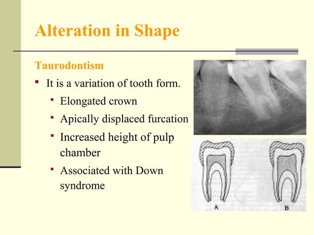 Teeth abnormalities ii | PPT