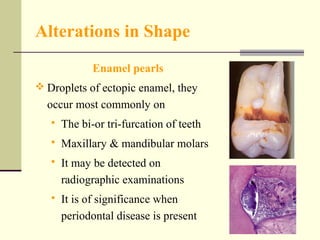 Teeth abnormalities ii | PPT