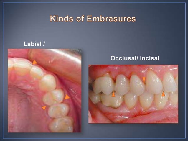 Physiology of Teeth and Its Supporting Structures | PPTX