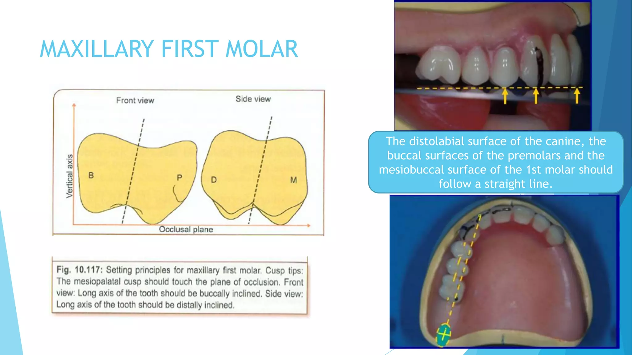 Teeth arrangement in balanced occlusion | PPTX