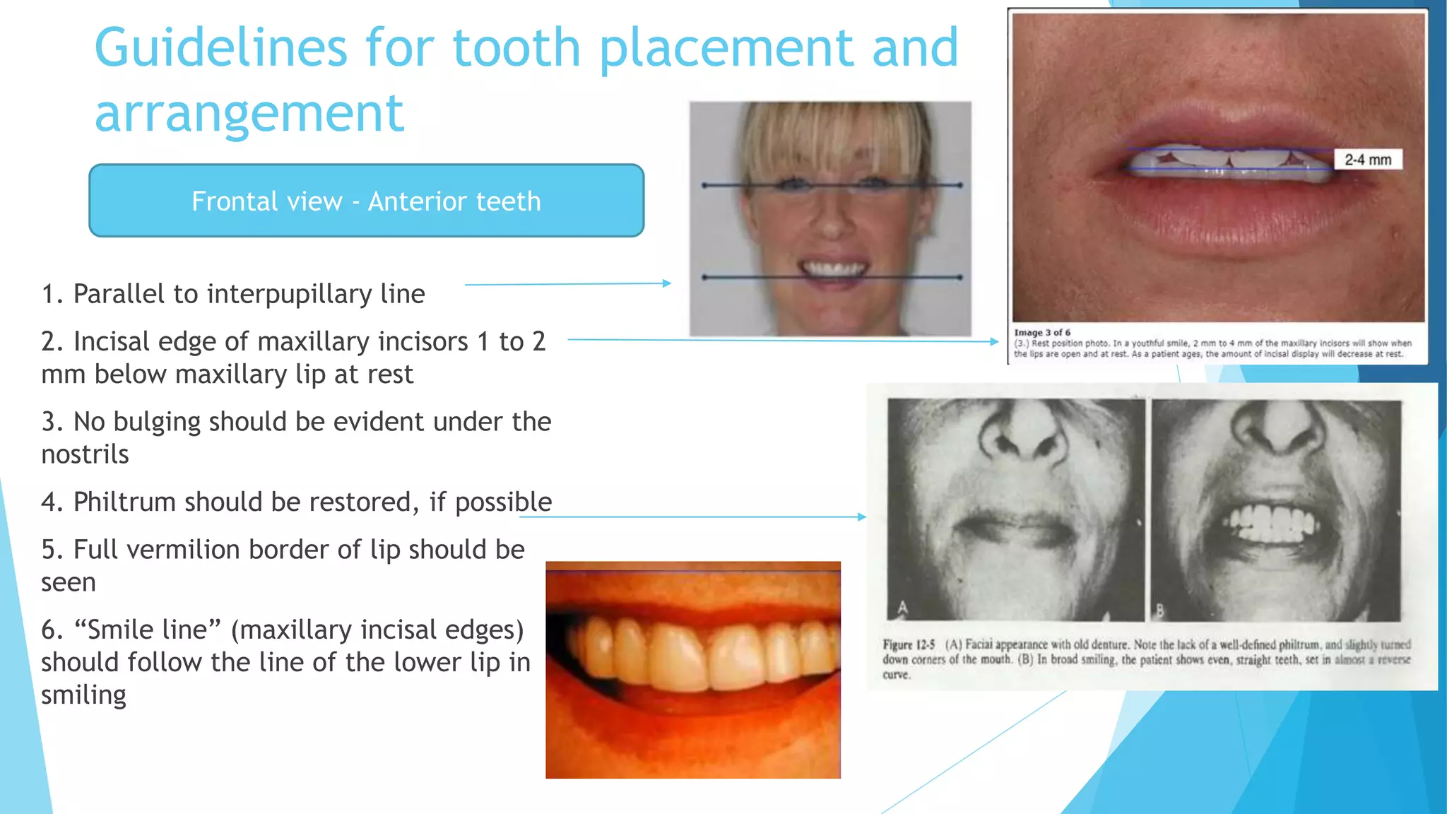 Teeth arrangement in balanced occlusion | PPTX