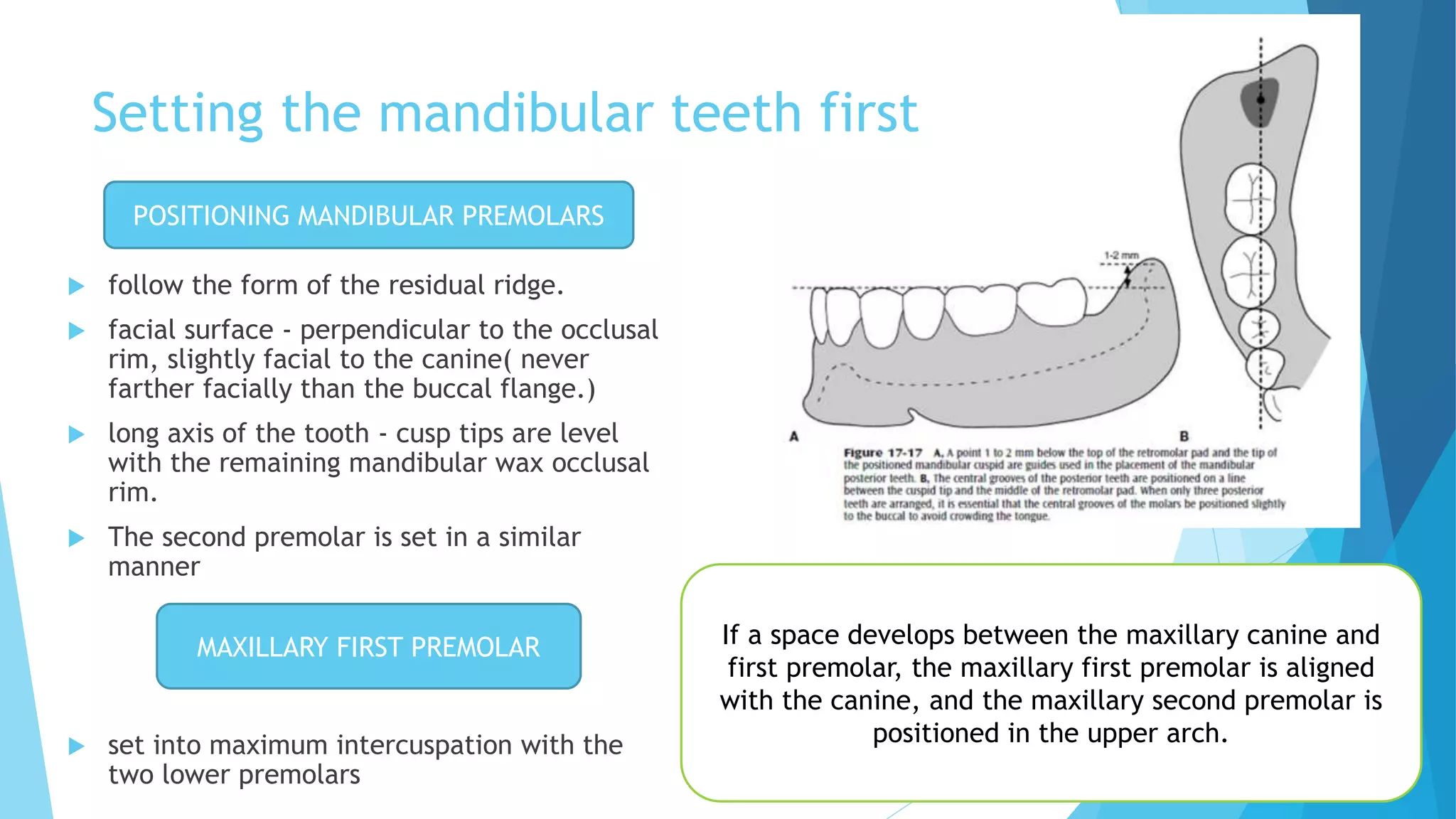 Teeth arrangement in balanced occlusion | PPTX