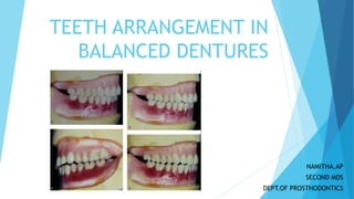 Teeth arrangement in balanced occlusion | PPTX