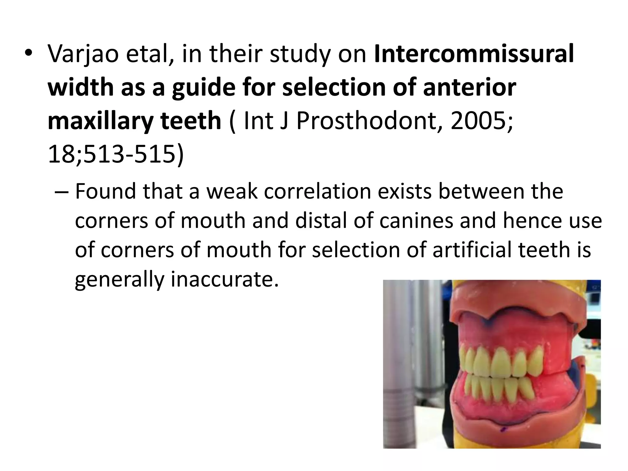 Teeth arrangement | PPTX