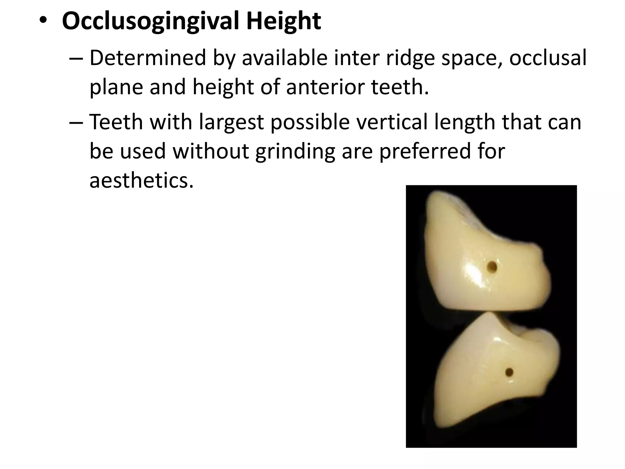 Teeth arrangement | PPTX