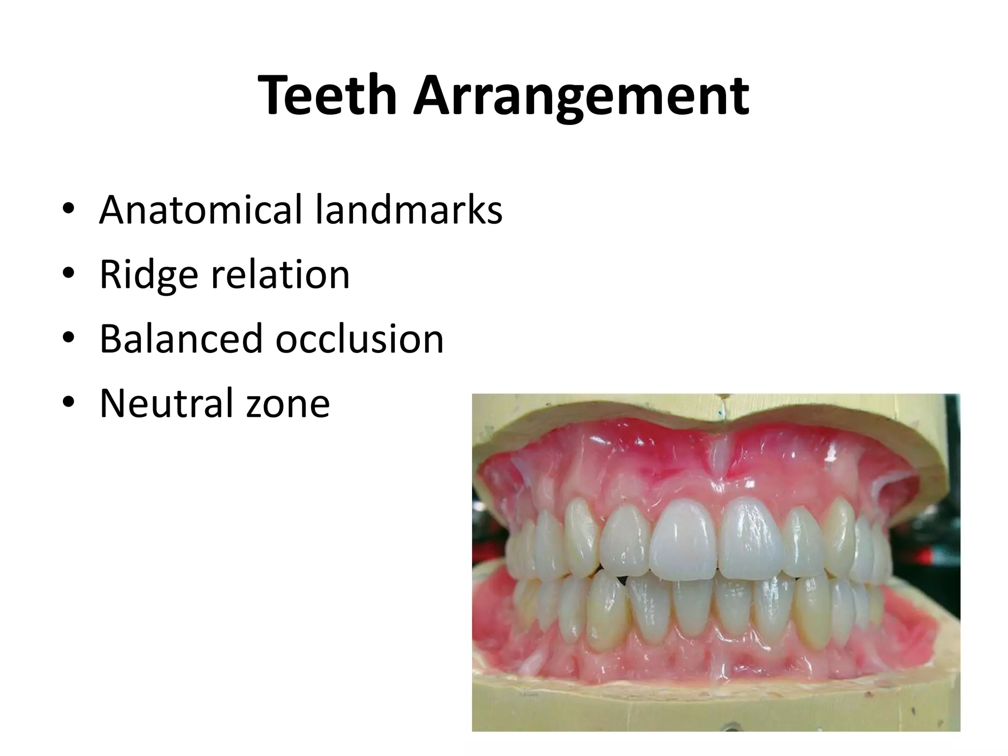 Teeth arrangement | PPTX