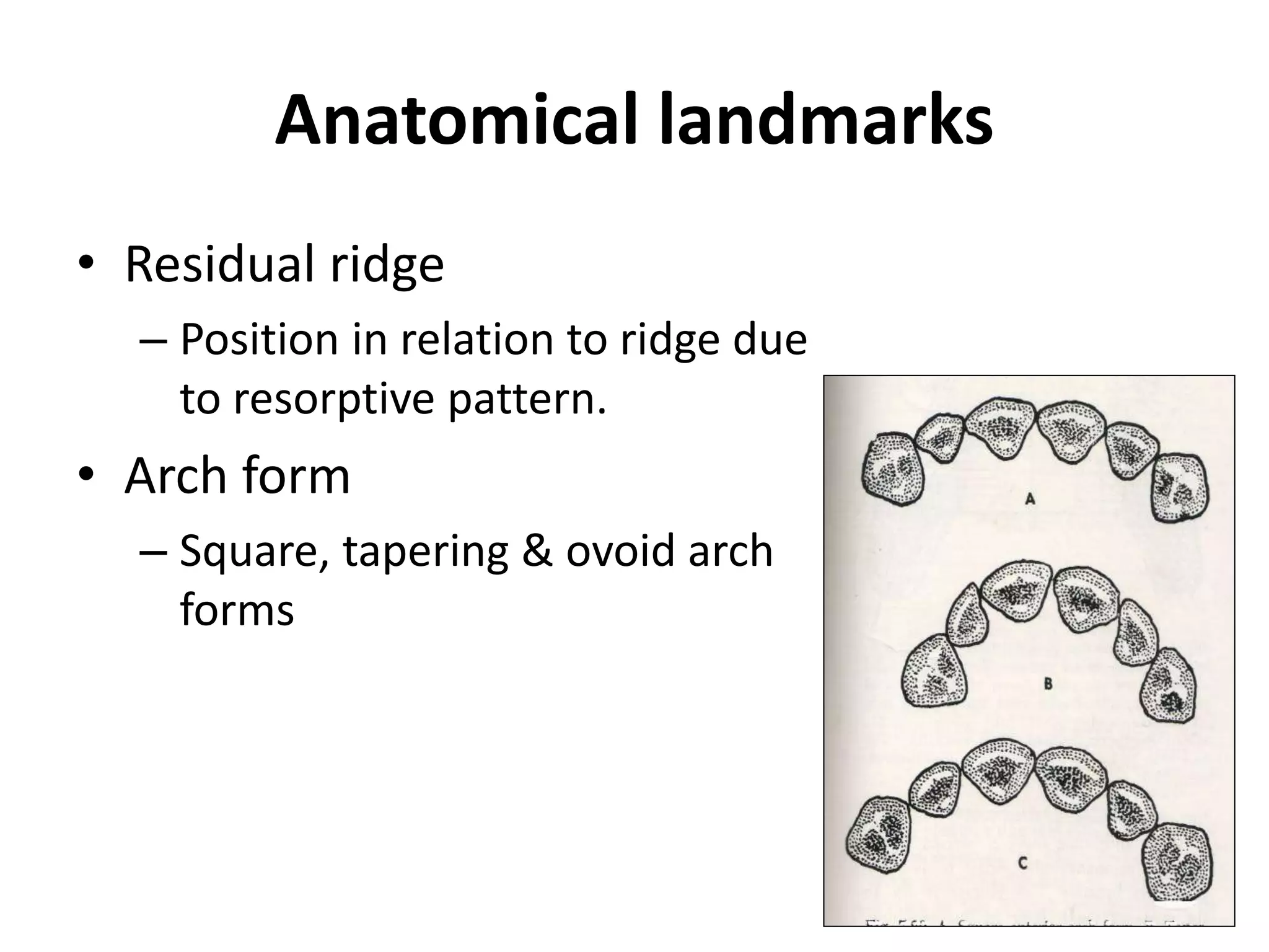 Teeth arrangement | PPTX