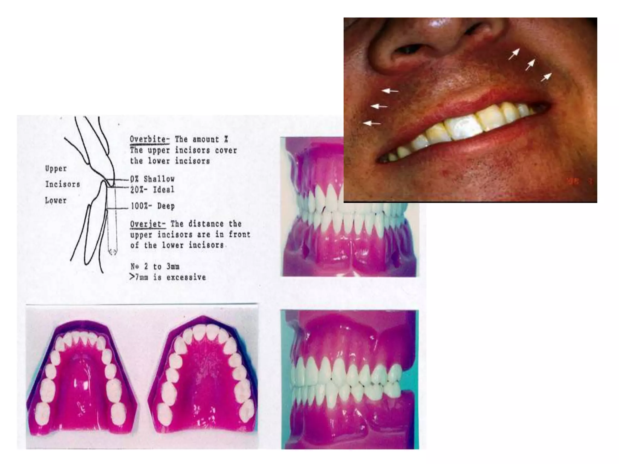 Teeth arrangement | PPTX