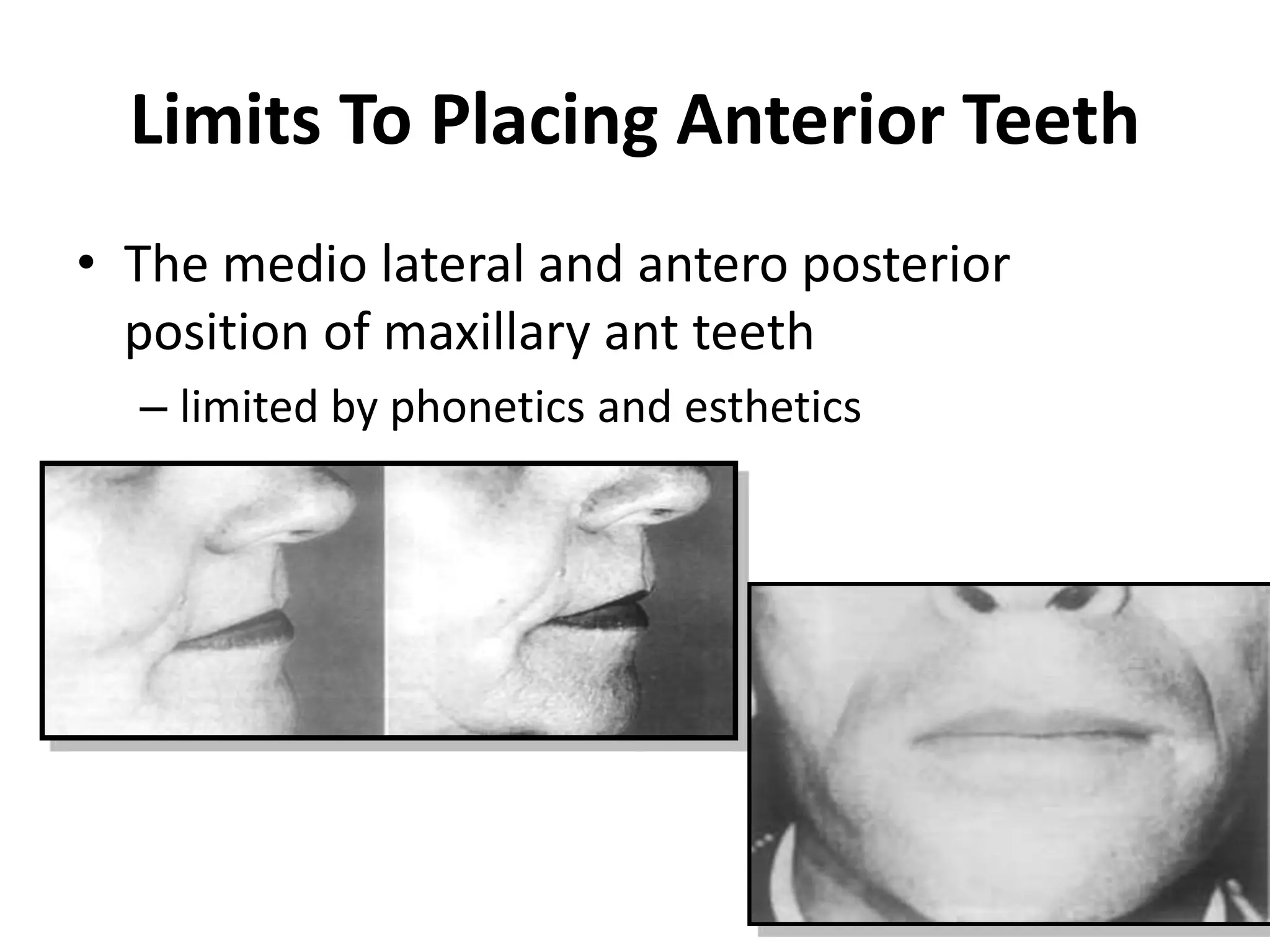 Teeth arrangement | PPTX