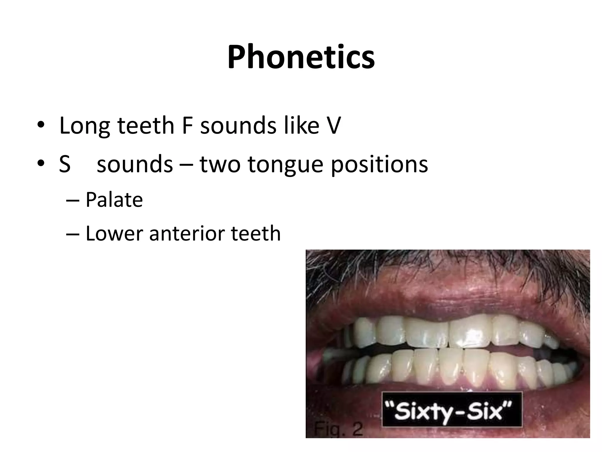 Teeth arrangement | PPTX