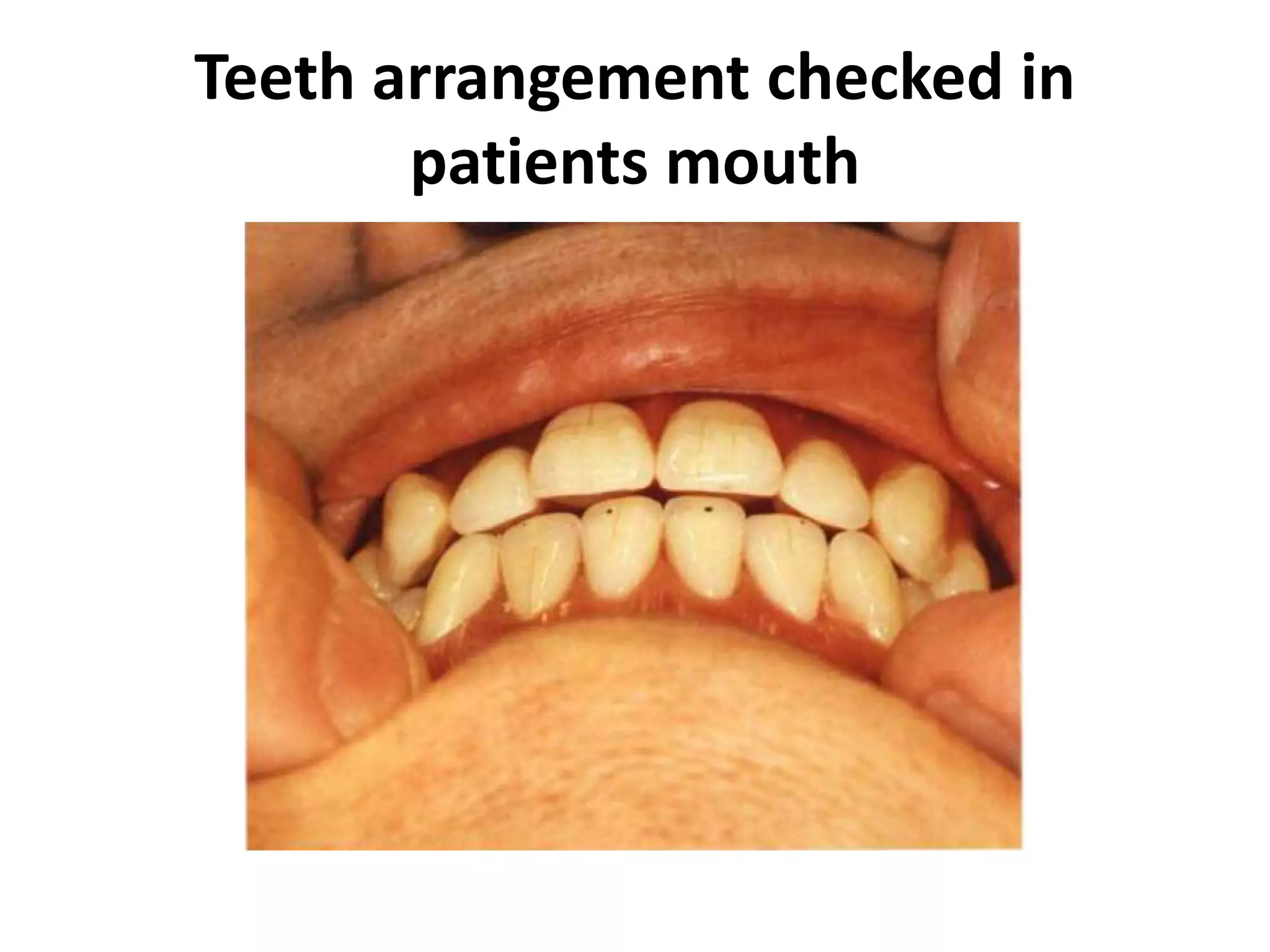 Teeth arrangement | PPTX