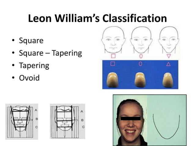 Teeth arrangement | PPTX