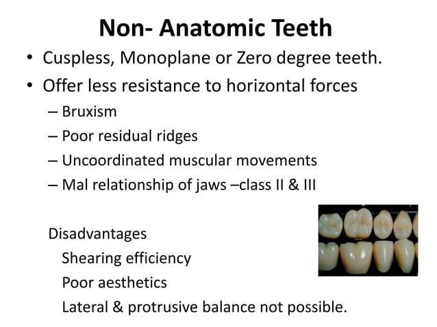 Teeth arrangement | PPTX