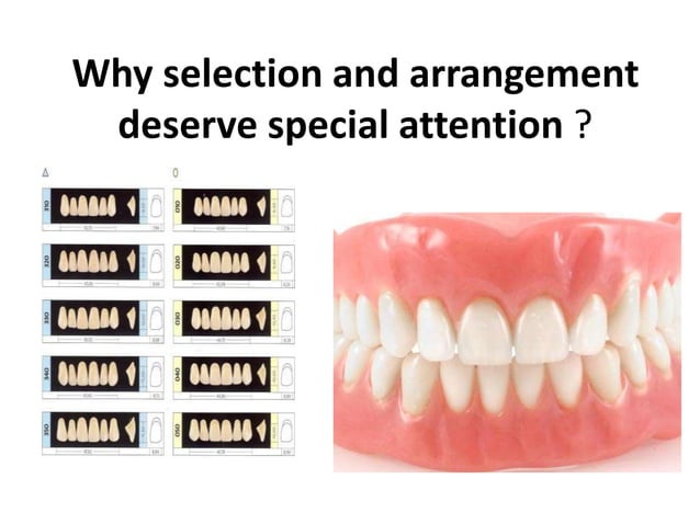 Teeth arrangement | PPTX
