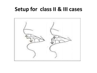 Teeth arrangement | PPTX