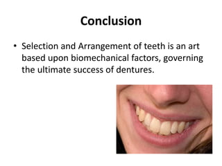 Teeth arrangement | PPTX
