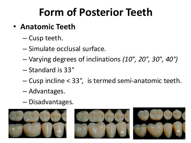 Teeth arrangement