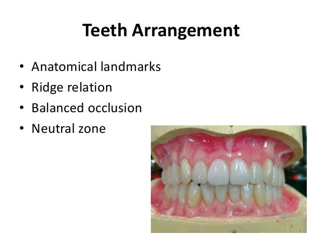 Teeth arrangement