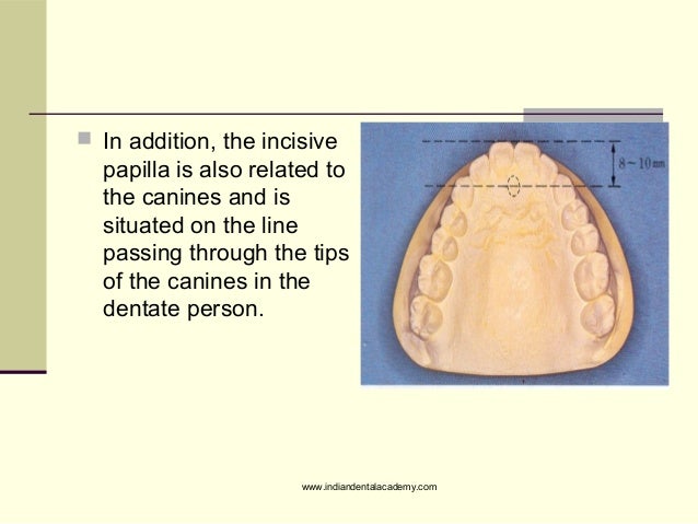 Teeth arrangement for complete dentures/ orthodontics courses online