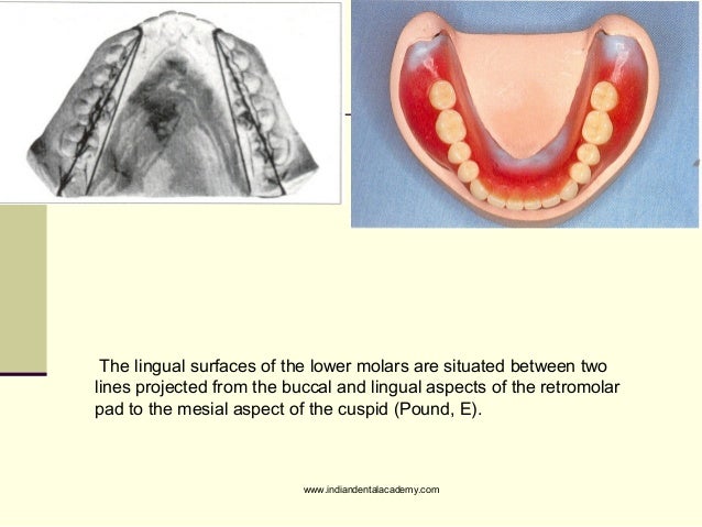 Teeth arrangement for complete dentures/ orthodontics courses online