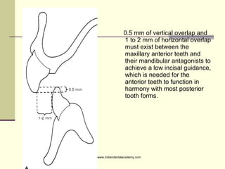 Teeth arrangement for complete dentures/cosmetic dentistry courses | PPT