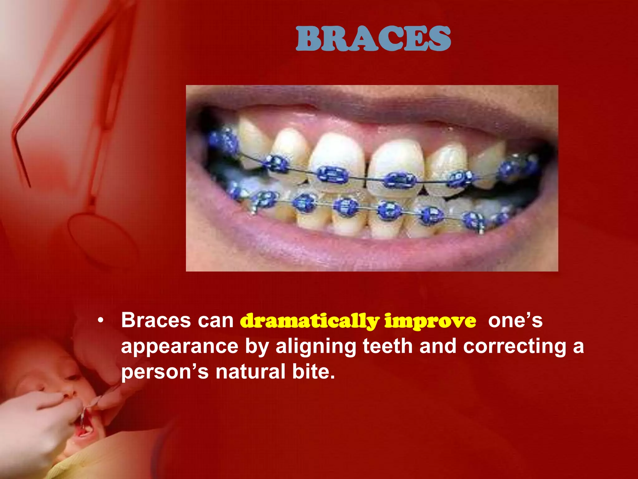 Teeth braces | PPTX
