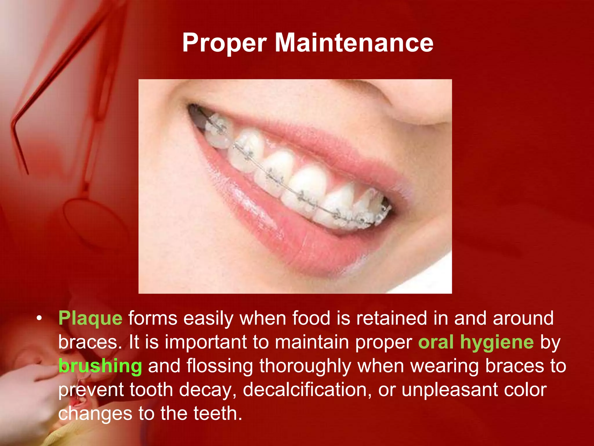 Teeth braces | PPTX