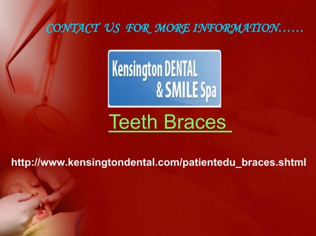 Teeth braces | PPTX | Oral care | Personal Care