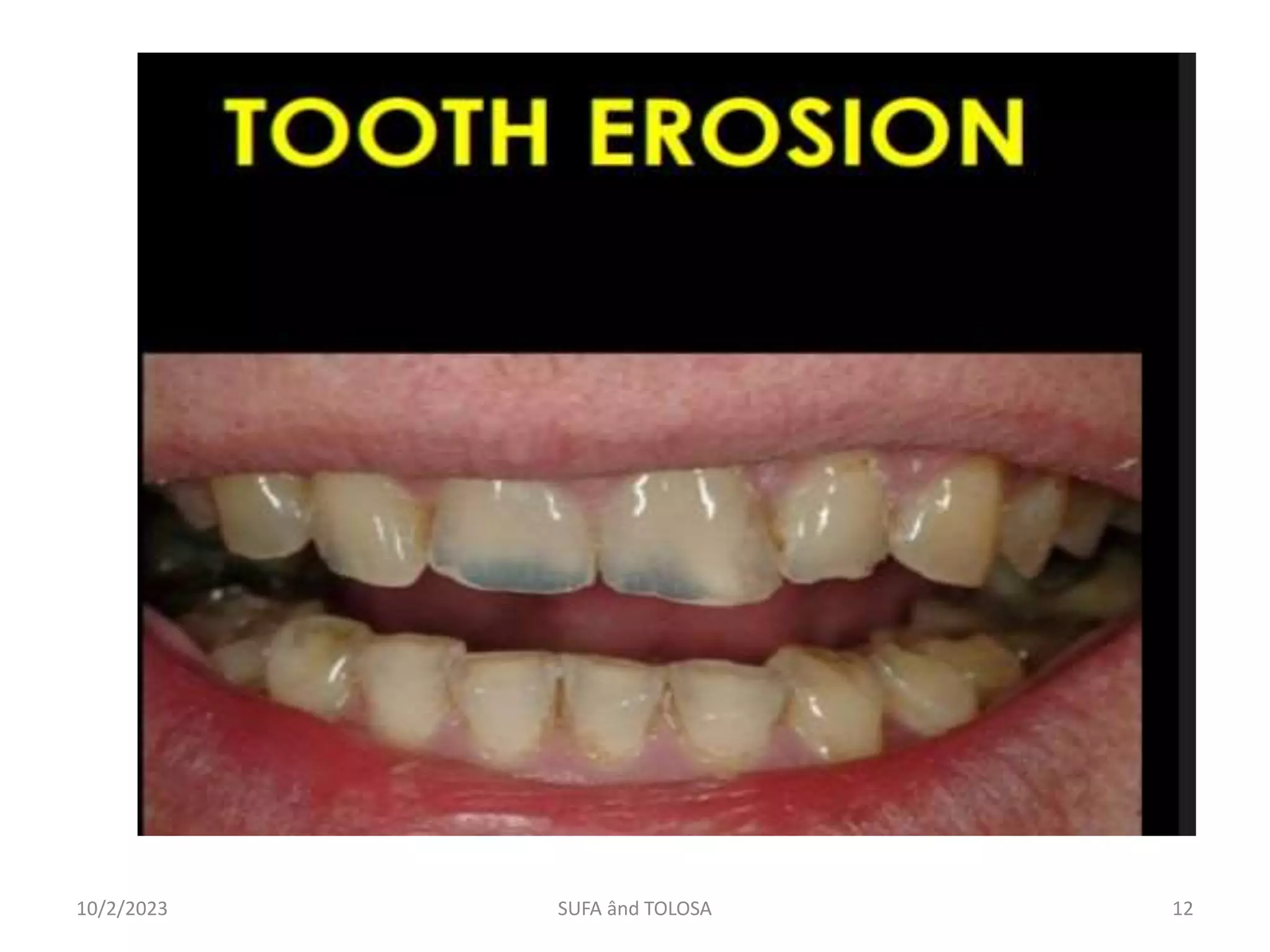 teeth disorders seminar presentation.pptx