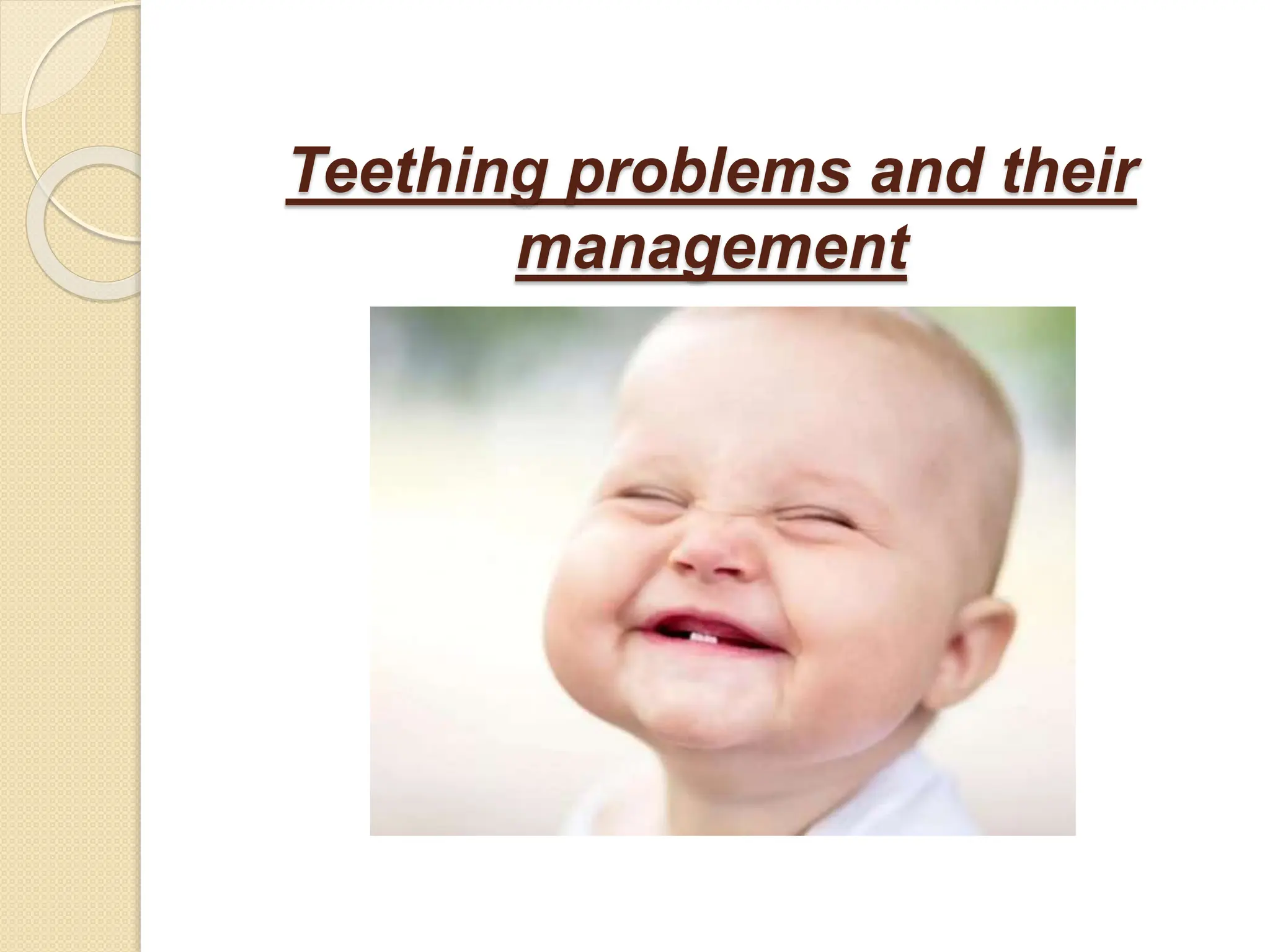 Teething problems and their management.pptx