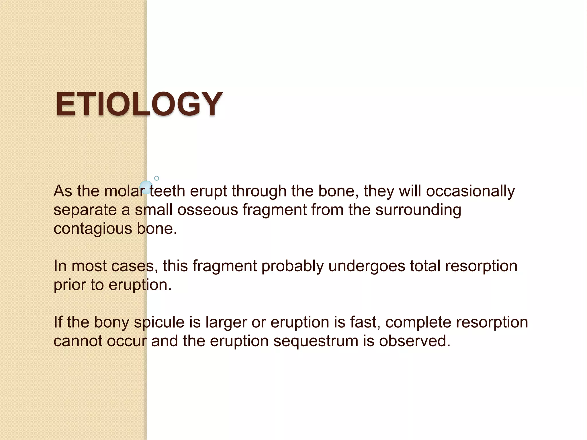 Teething problems & management | PPTX