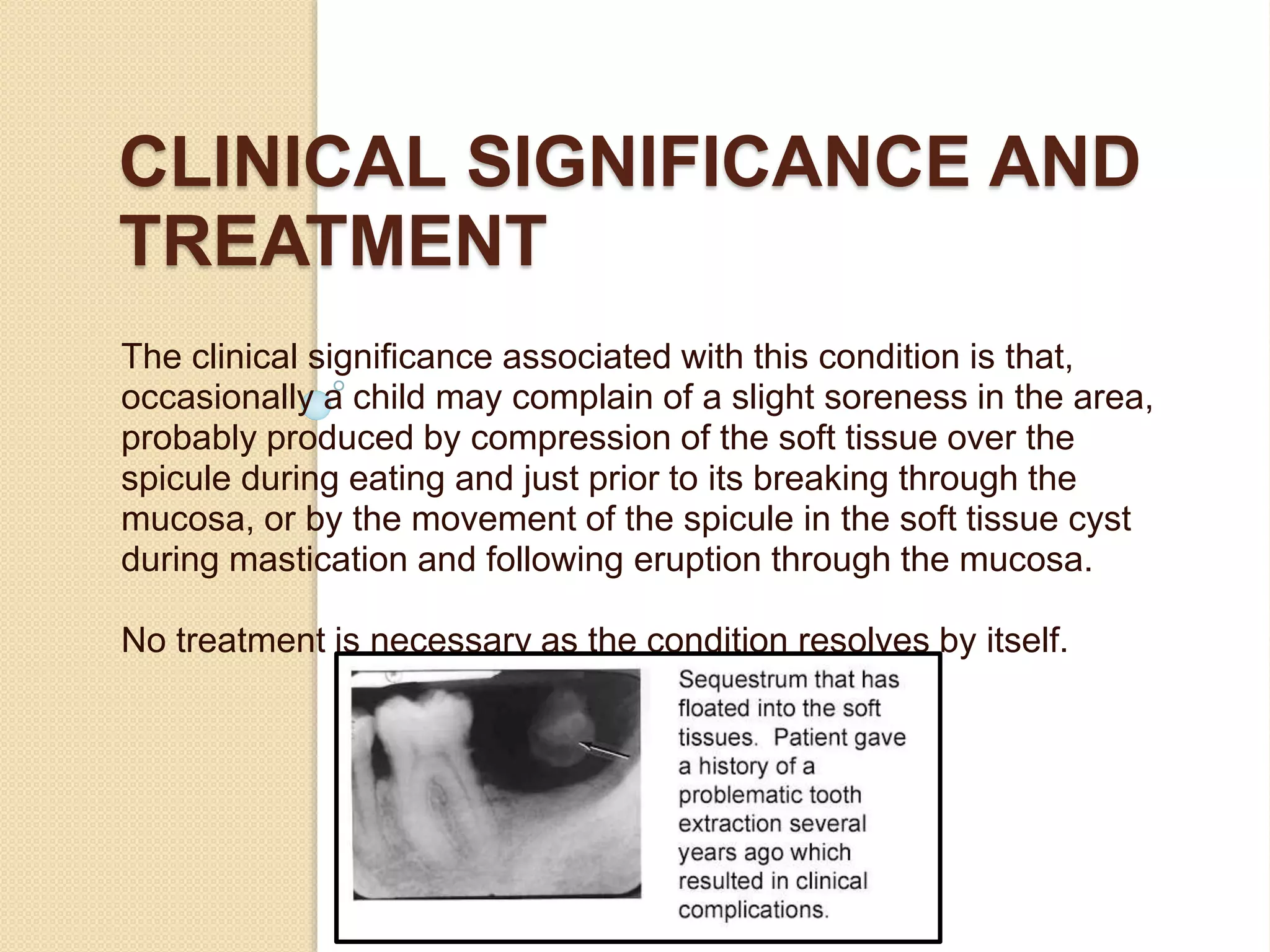 Teething problems & management | PPTX