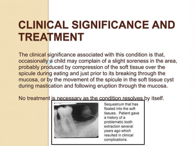 Teething problems & management | PPTX | Dental Health | Diseases and ...