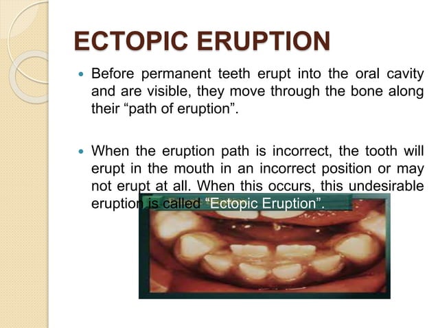 Teething problems & management | PPTX | Dental Health | Diseases and ...