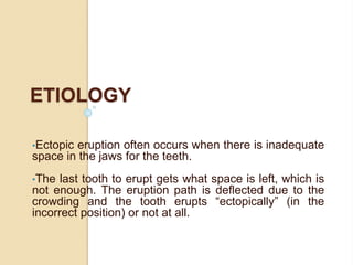 Teething problems & management | PPTX