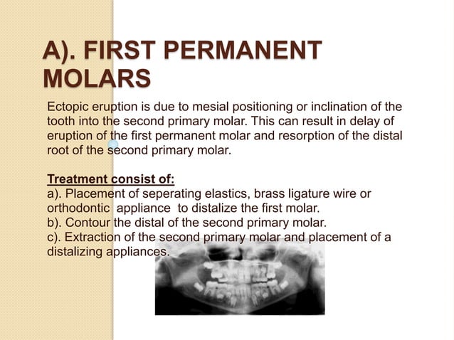 Teething problems & management | PPTX | Dental Health | Diseases and ...