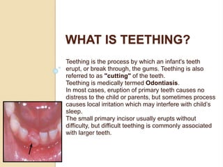 Teething problems & management | PPTX