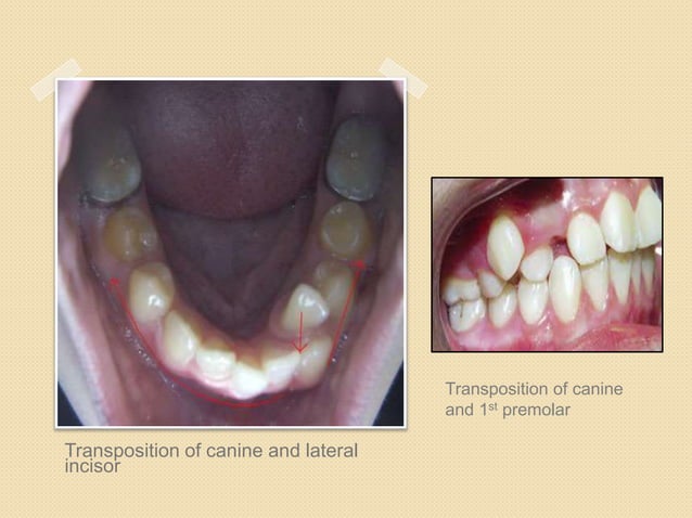 Teething problems & management | PPTX | Dental Health | Diseases and ...