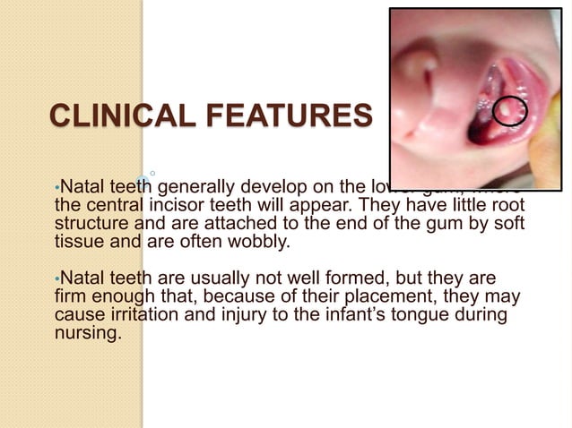 Teething problems & management | PPTX | Dental Health | Diseases and Conditions