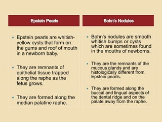 Teething problems & management | PPT