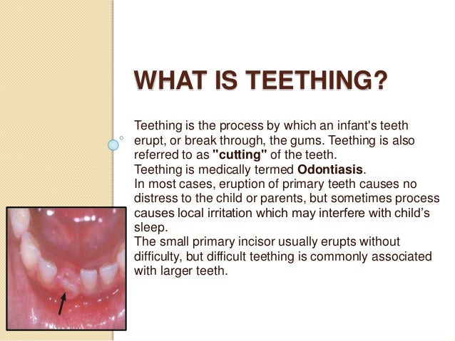 Teething problems & management