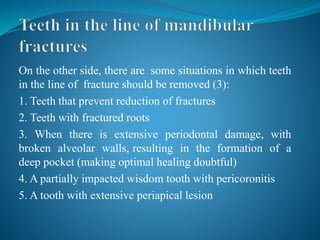 Teeth in The Line of Mandibular Fractures | PPTX