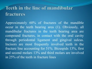Teeth in The Line of Mandibular Fractures | PPT