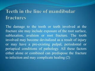 Teeth in The Line of Mandibular Fractures | PPT