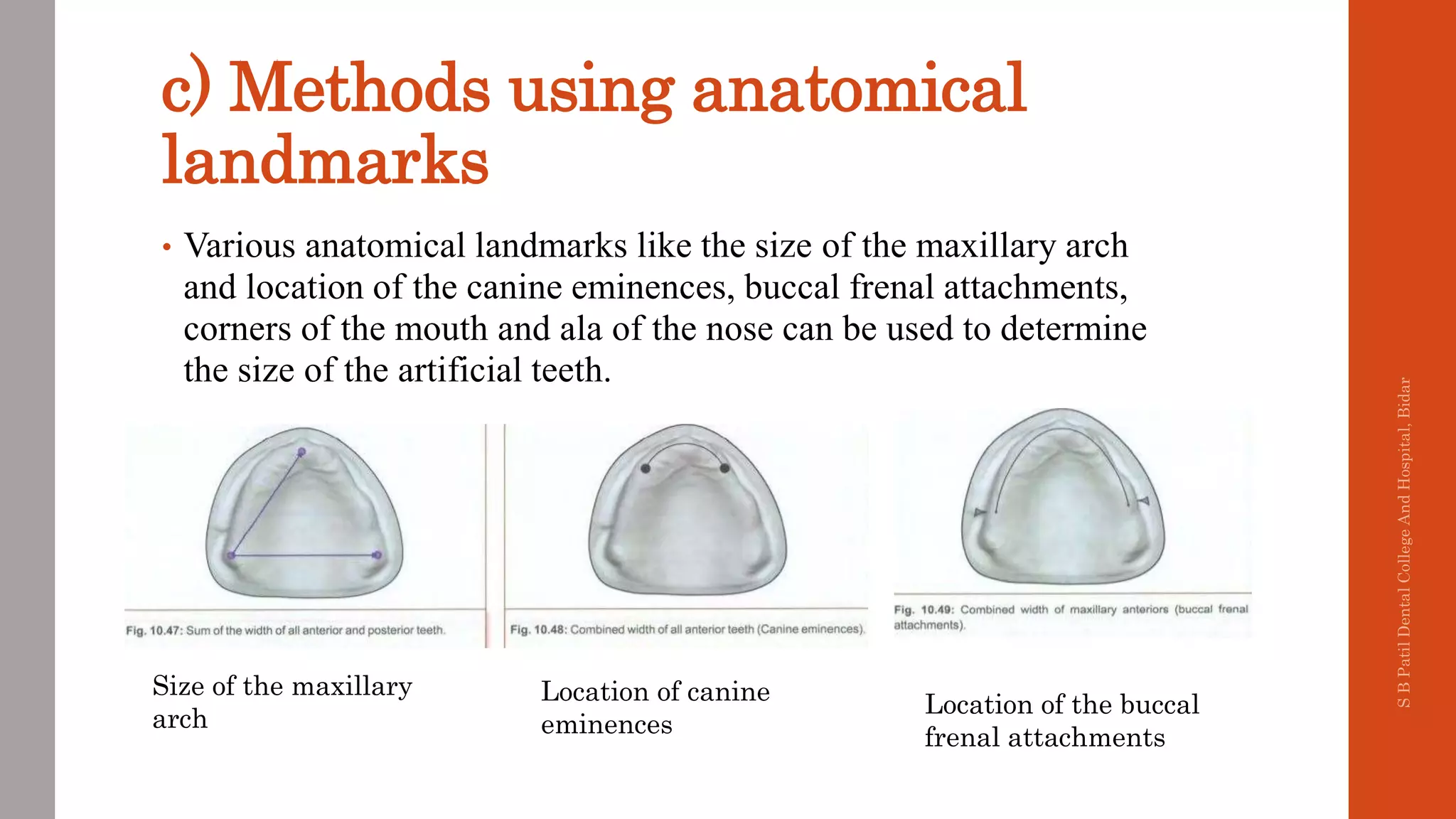 TEETH SELECTION IN COMPLETE DENTURE | PPTX
