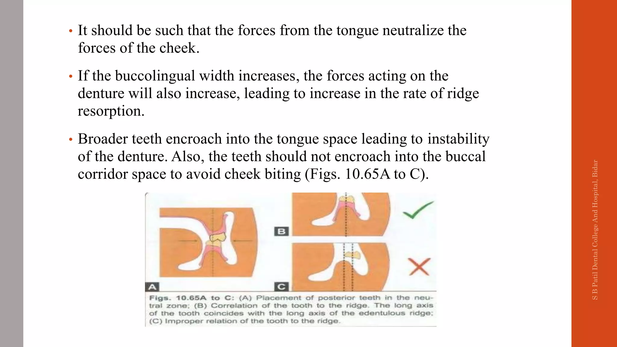 TEETH SELECTION IN COMPLETE DENTURE | PPTX
