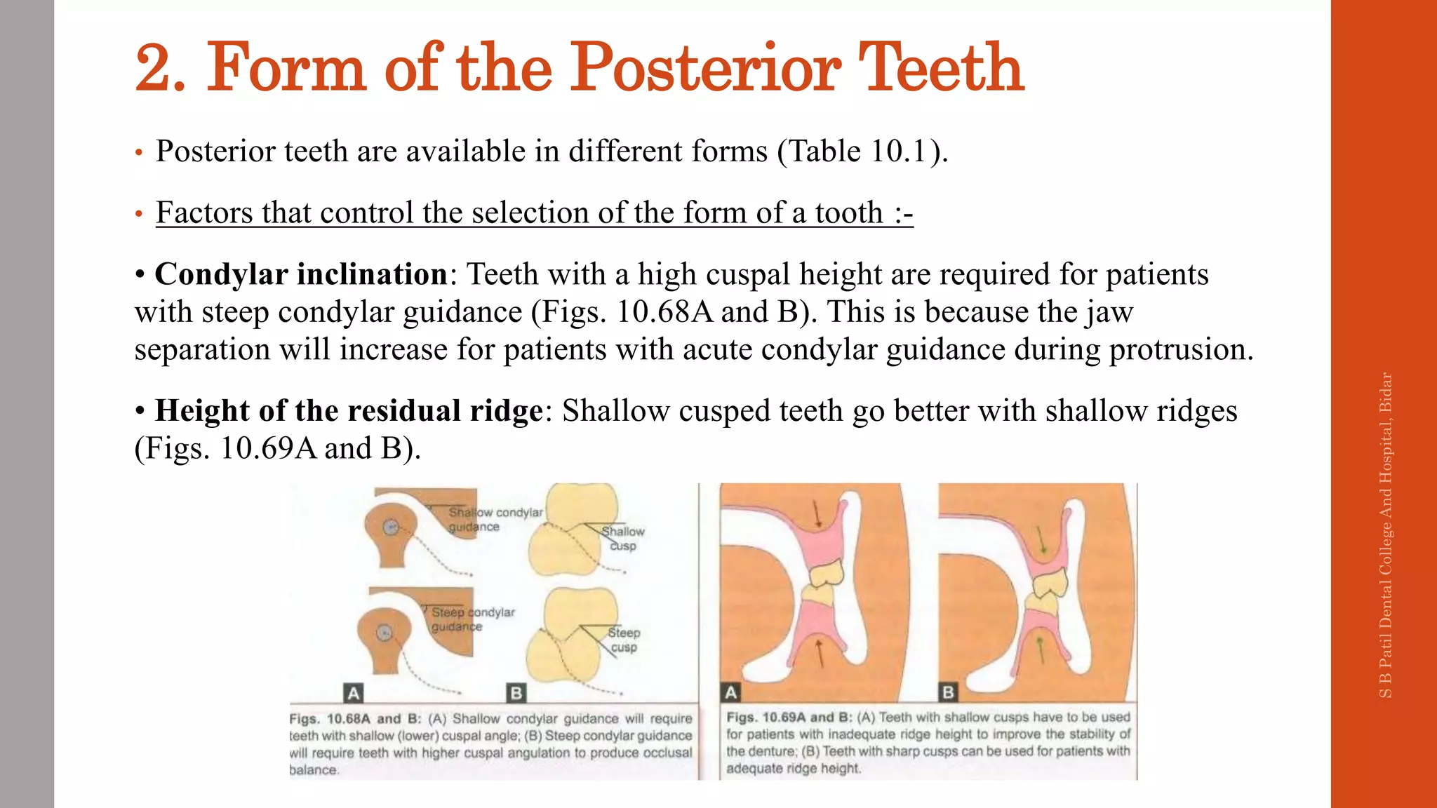 TEETH SELECTION IN COMPLETE DENTURE | PPTX