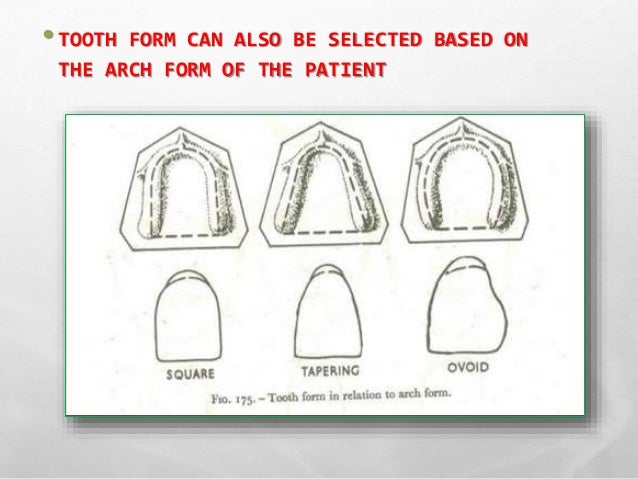 Teeth selection for complete dentures